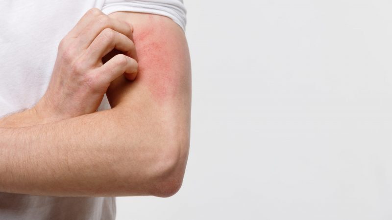 National Post: How to heal dry skin, according to a top dermatologist ...