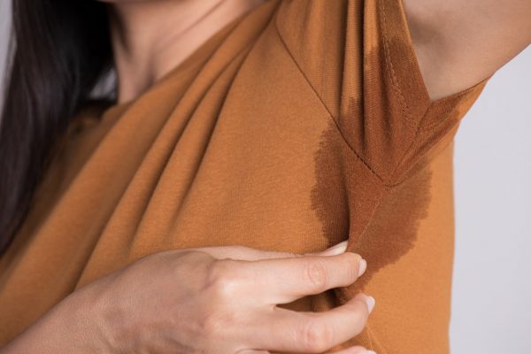 All About Hyperhidrosis - Toronto Dermatology Centre