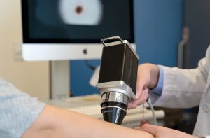 Mole Mapping | Melanoma Skin Cancer - Toronto Dermatology Centre