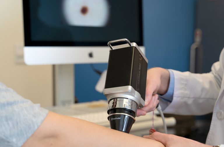 Mole Mapping | Melanoma Skin Cancer - Toronto Dermatology Centre
