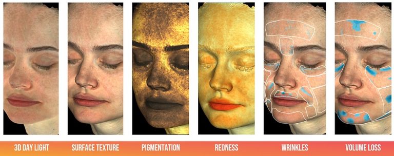 Skin Analyser Technology - Toronto Dermatology Centre