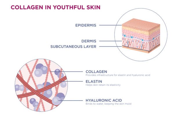 Sculptra - Toronto Dermatology Centre