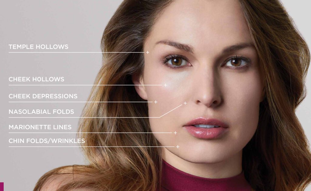 Sculptra - Toronto Dermatology Centre