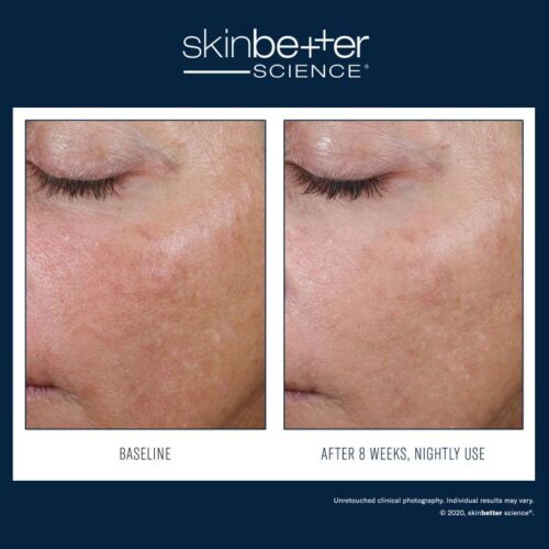 Alpharet Overnight Cream - Toronto Dermatology Centre