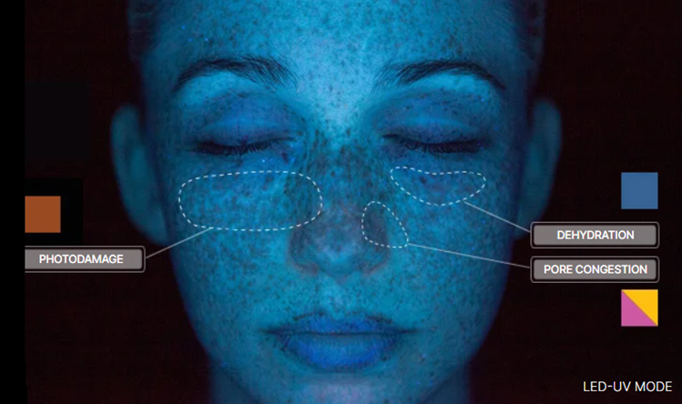 Facials | Skin Treatments - Toronto Dermatology Centre
