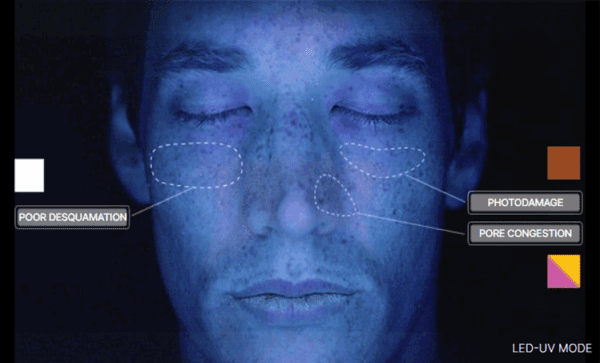 Facials | Skin Treatments - Toronto Dermatology Centre